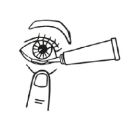 Treatment | GoldenEye | Our Easy To Use Eye Care Products